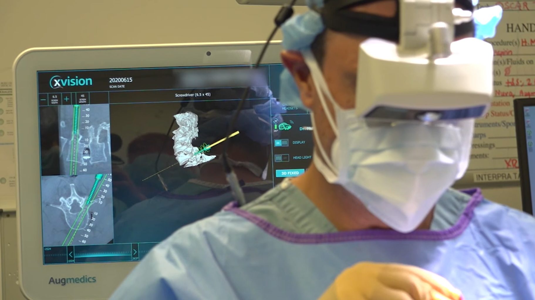 Augmedics’ Augmented Reality surgical guidance technology used in ...