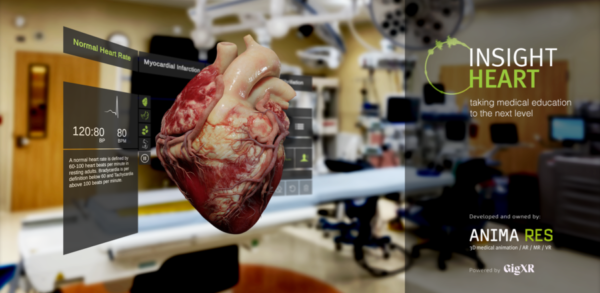 GigXR integrates ANIMA RES Insight Series for 3D anatomy learning